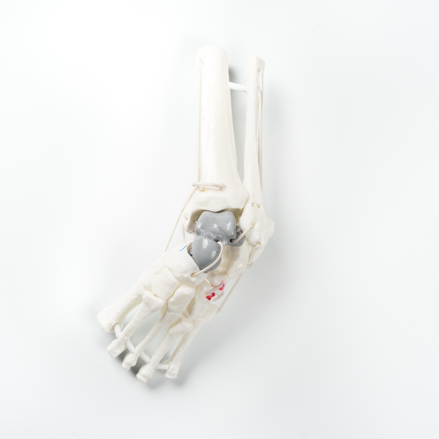 Vertical Talus Bone Foot Model – Stepify
